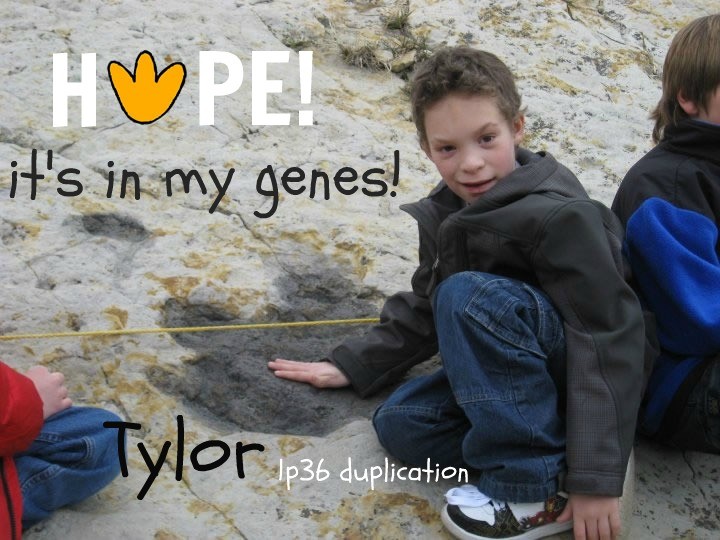 1p36 Duplication: Ten Miracle Years - Global Genes