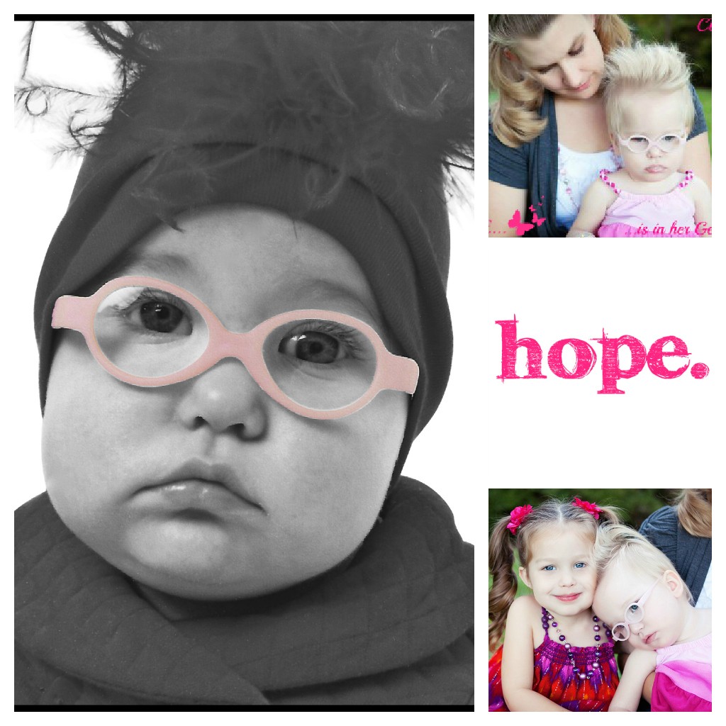 CDKL5 Disorder Causes Two Year Old Harper To Have Up To 20 Seizures Per ...