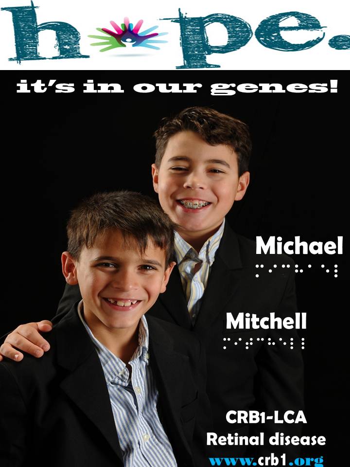 Brothers, with CRB1 Defect, Beat Blindness with Biking Events - Global ...