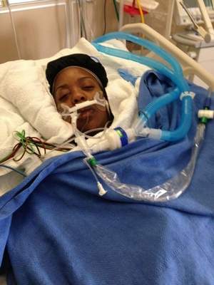 Pageant Queen Overcomes Stevens- Johnson Syndrome - Global Genes