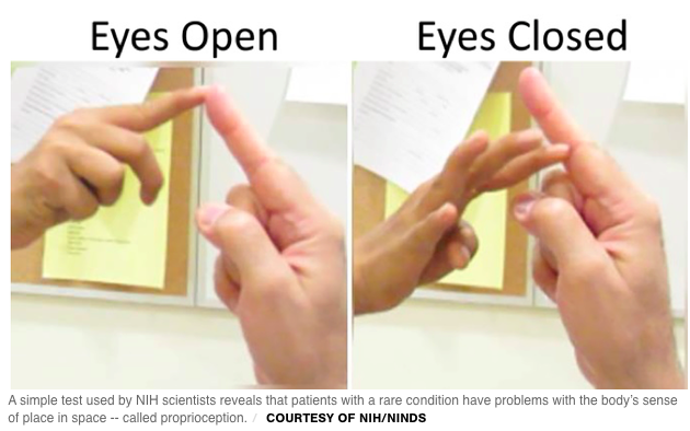 New Study Investigates "Touch Blindness" as Potential Genetic Mutation ...