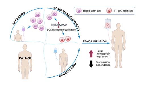 Sangamo And Bioverativ Say FDA Accepts Application to Begin Beta ...