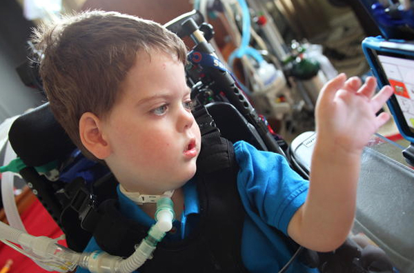 Audentes Doses First patient in Gene Therapy Trial for Rare Muscle ...