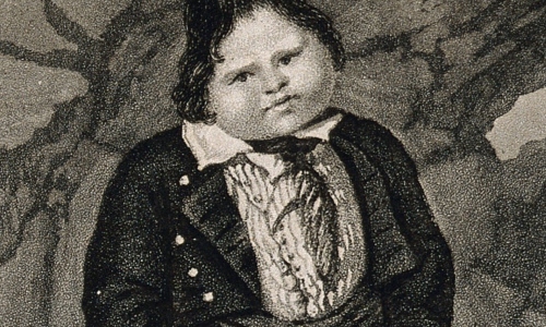 Registry Hopes to Shed Light on Rare Disorders of Genetic Obesity ...