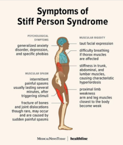 About Stiff Person Syndrome - Global Genes